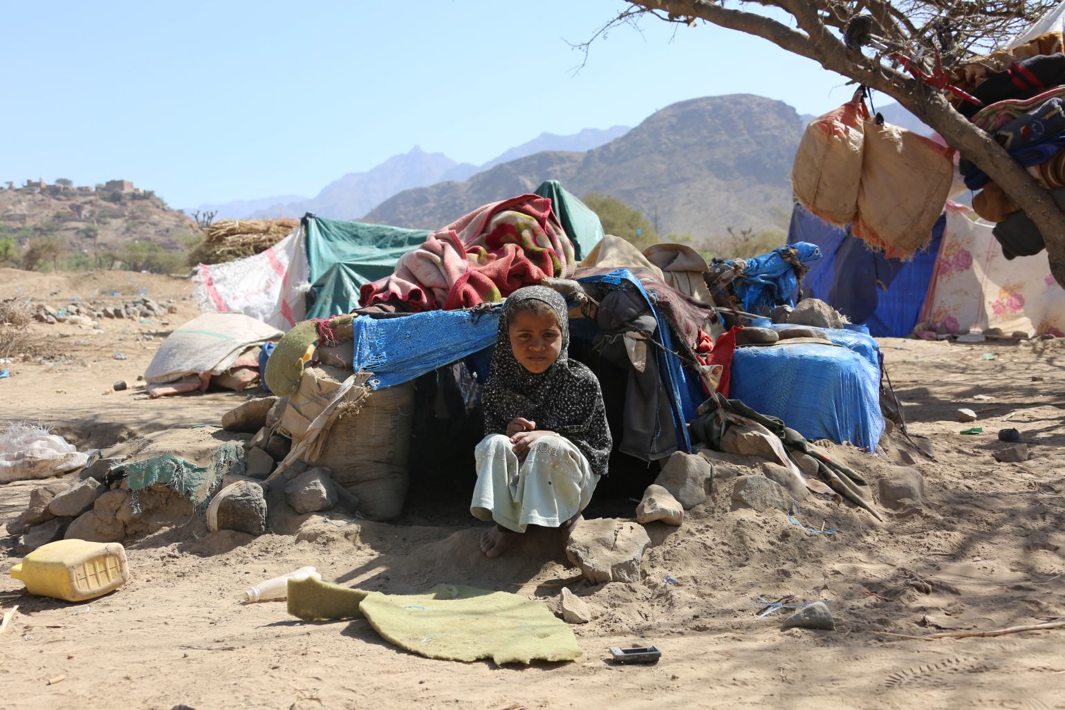 Hunger in Yemen